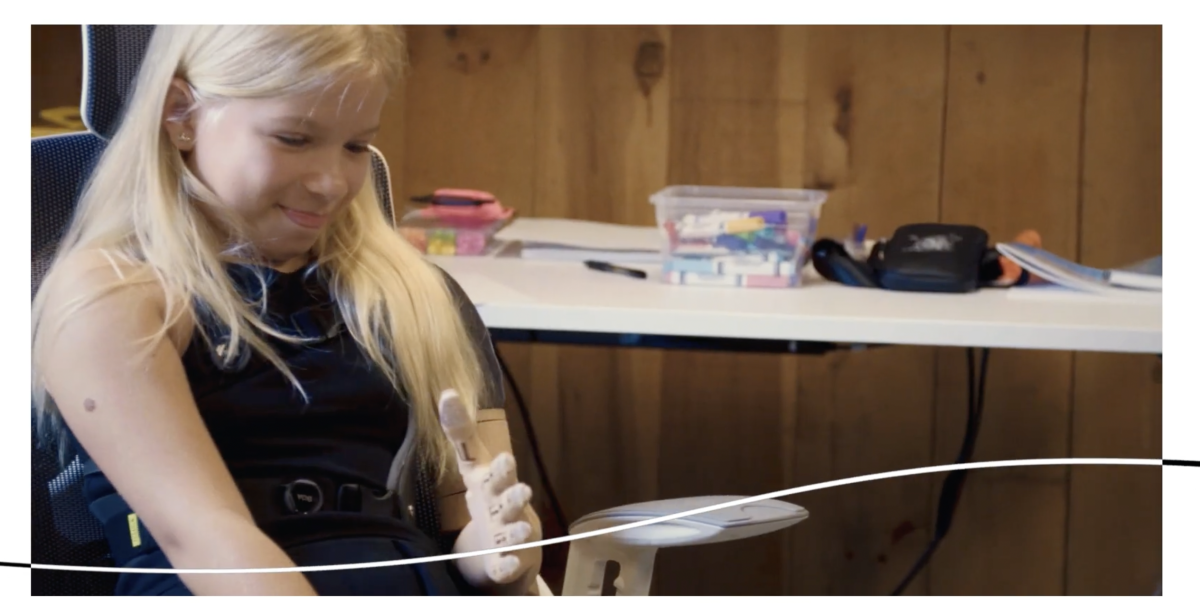 Possibilities Through Prosthetics